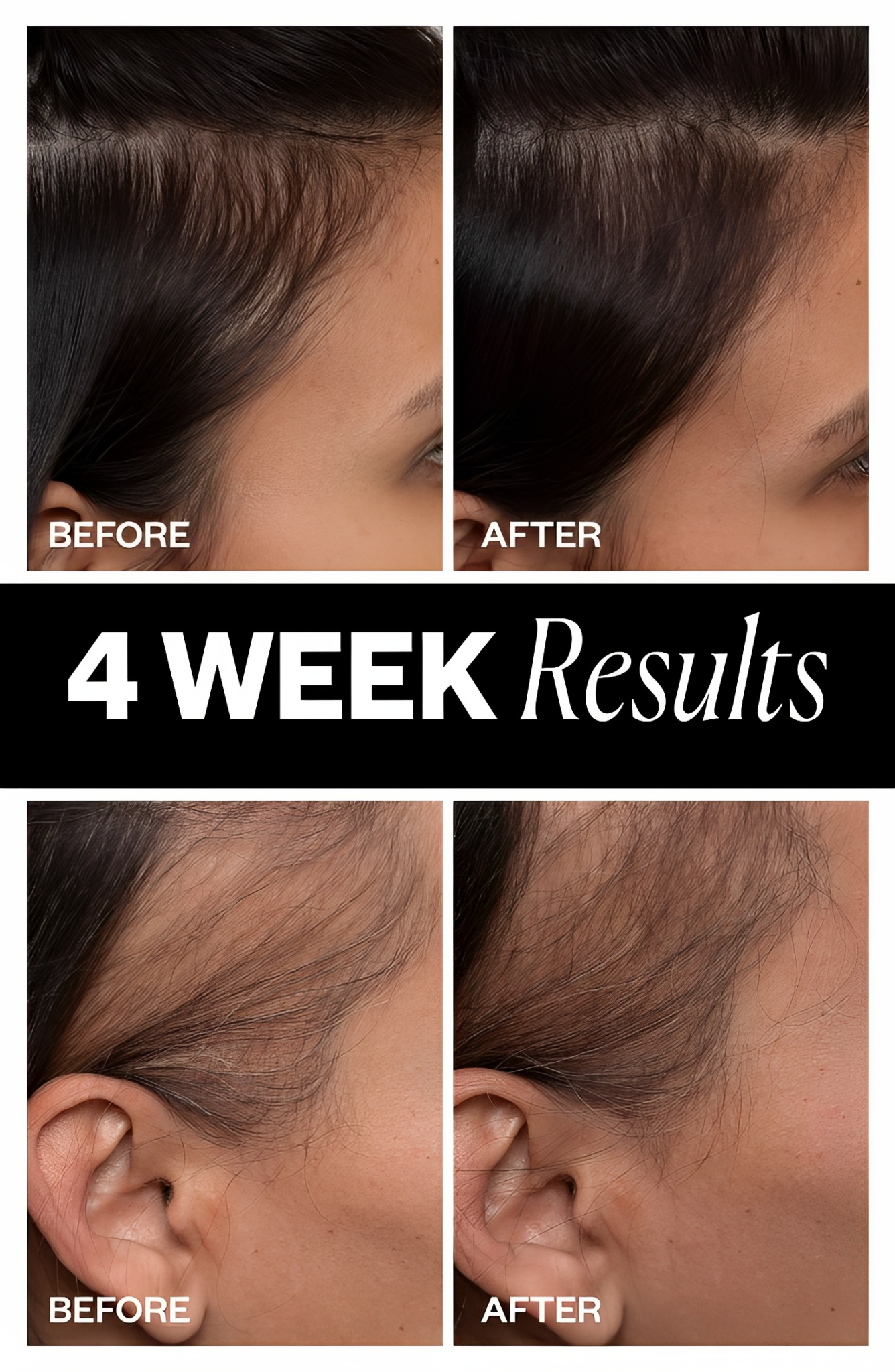 Scalp Threads in Kochi – Advanced Hair Rejuvenation at Jeny’s